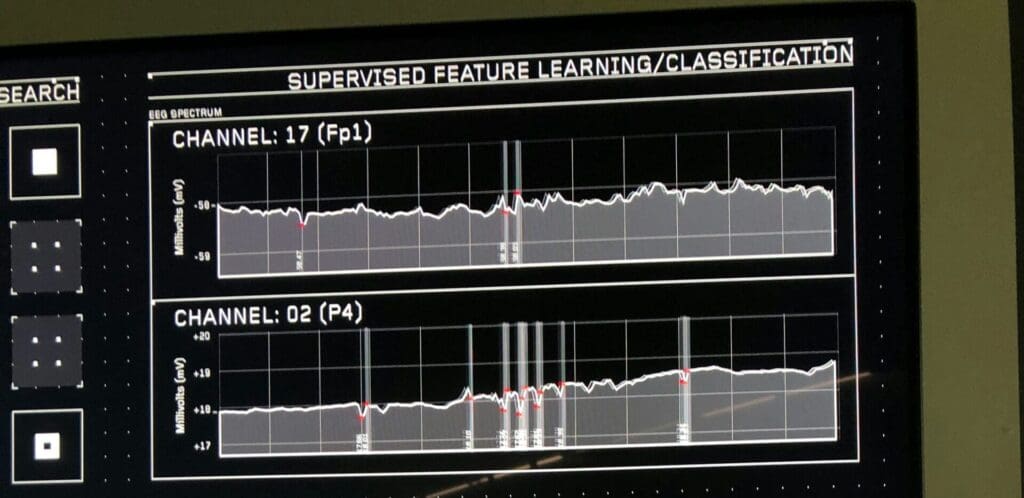 What is Supervised Learning? Types, Applications and Best Practices